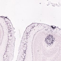 High Resolution Image Viewer :: Allen Brain Atlas: Mouse Brain